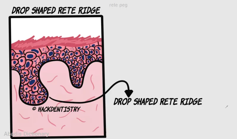 rete peg - معنی تخصصی در دیکشنری آبادیس